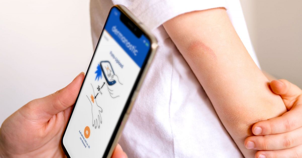 dermanostic - Hautarzt per App - digitale Arztberatung rund um die Uhr ...